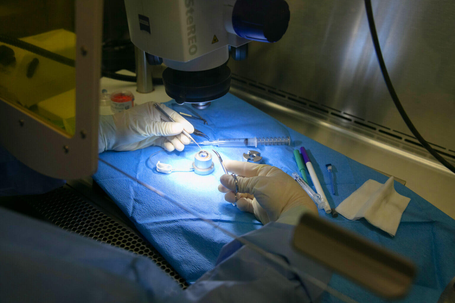 Tissue and Eye Banks and Organ Procurement Organizations Respond to ...